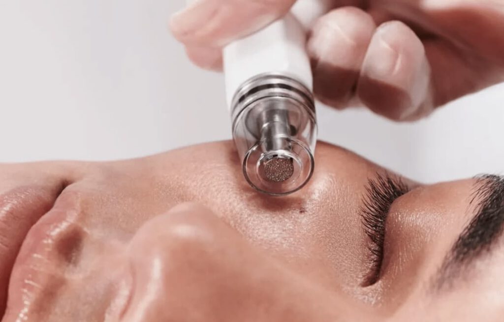 Diamond Glow: The Ultimate Skin Transformation | Evolve Med Spa